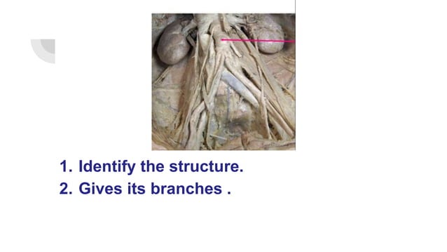 ABDOMEN ANATOMY SPOTTERS REVISION FOR FIRST MBBS.pptx