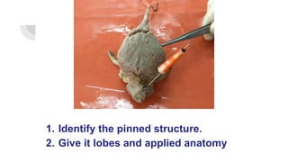 ABDOMEN ANATOMY SPOTTERS REVISION FOR FIRST MBBS.pptx