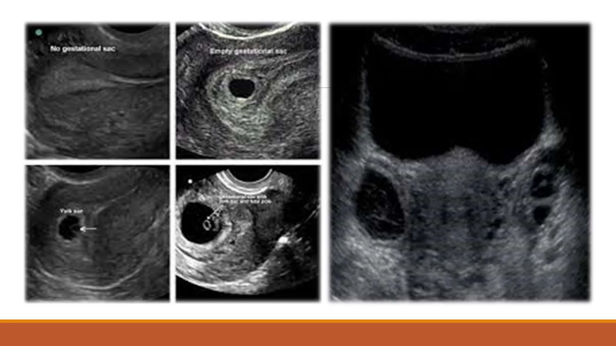 Abdomen ultrasound.pptx