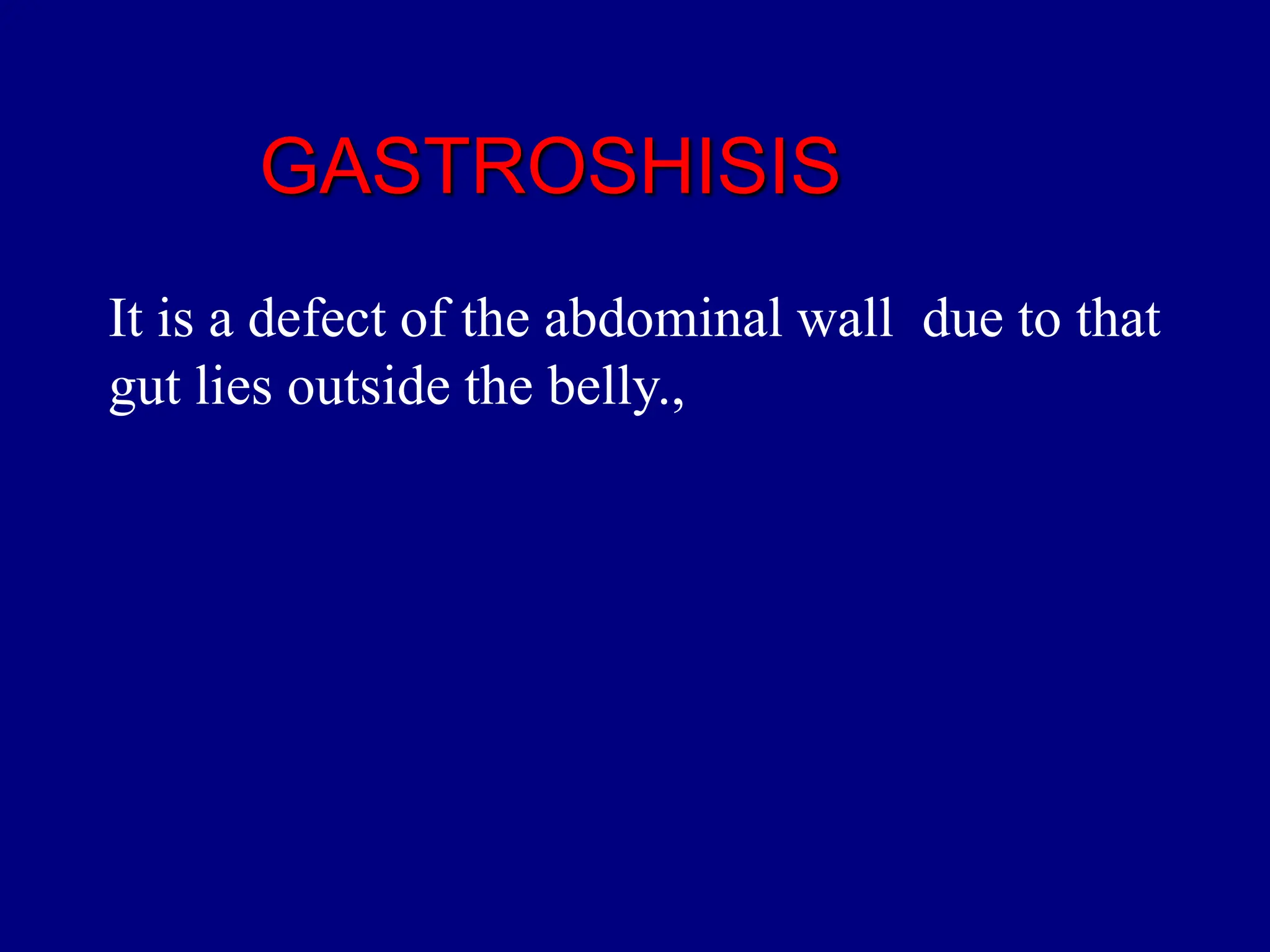abdomen wall defects in neonate,exomphalos.ppt