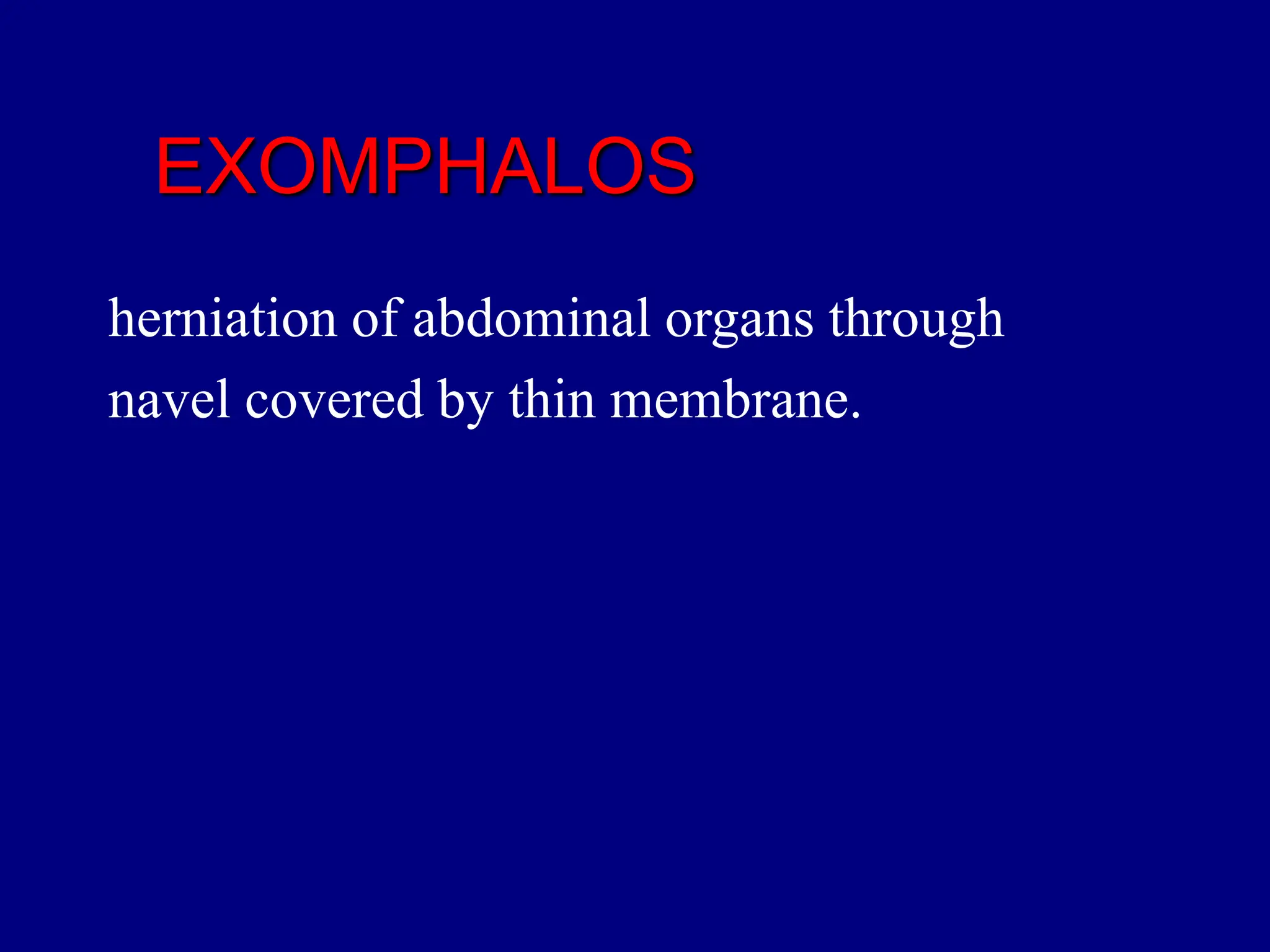abdomen wall defects in neonate,exomphalos.ppt