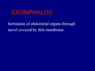 abdomen wall defects in neonate,exomphalos.ppt