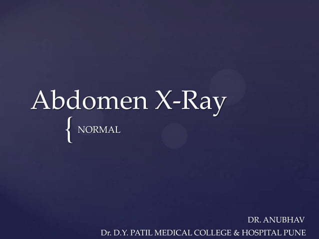 X Ray Normal Abdomen | PPTX