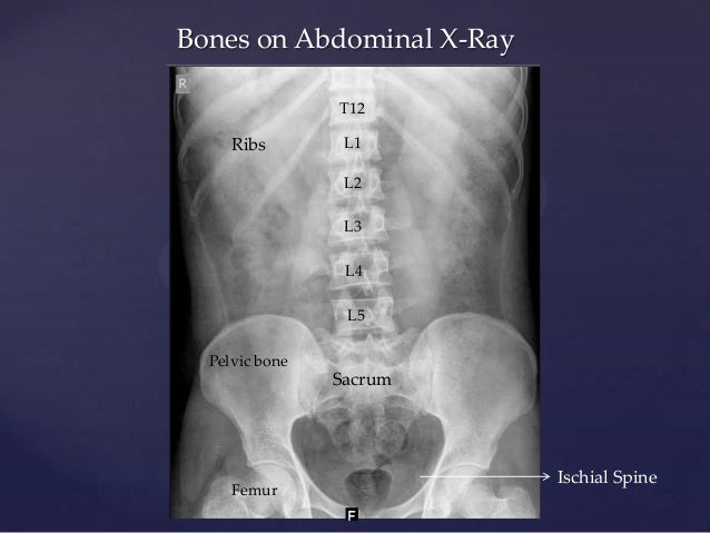 X Ray Normal Abdomen