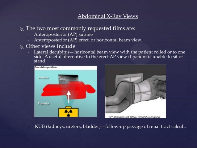 X Ray Normal Abdomen