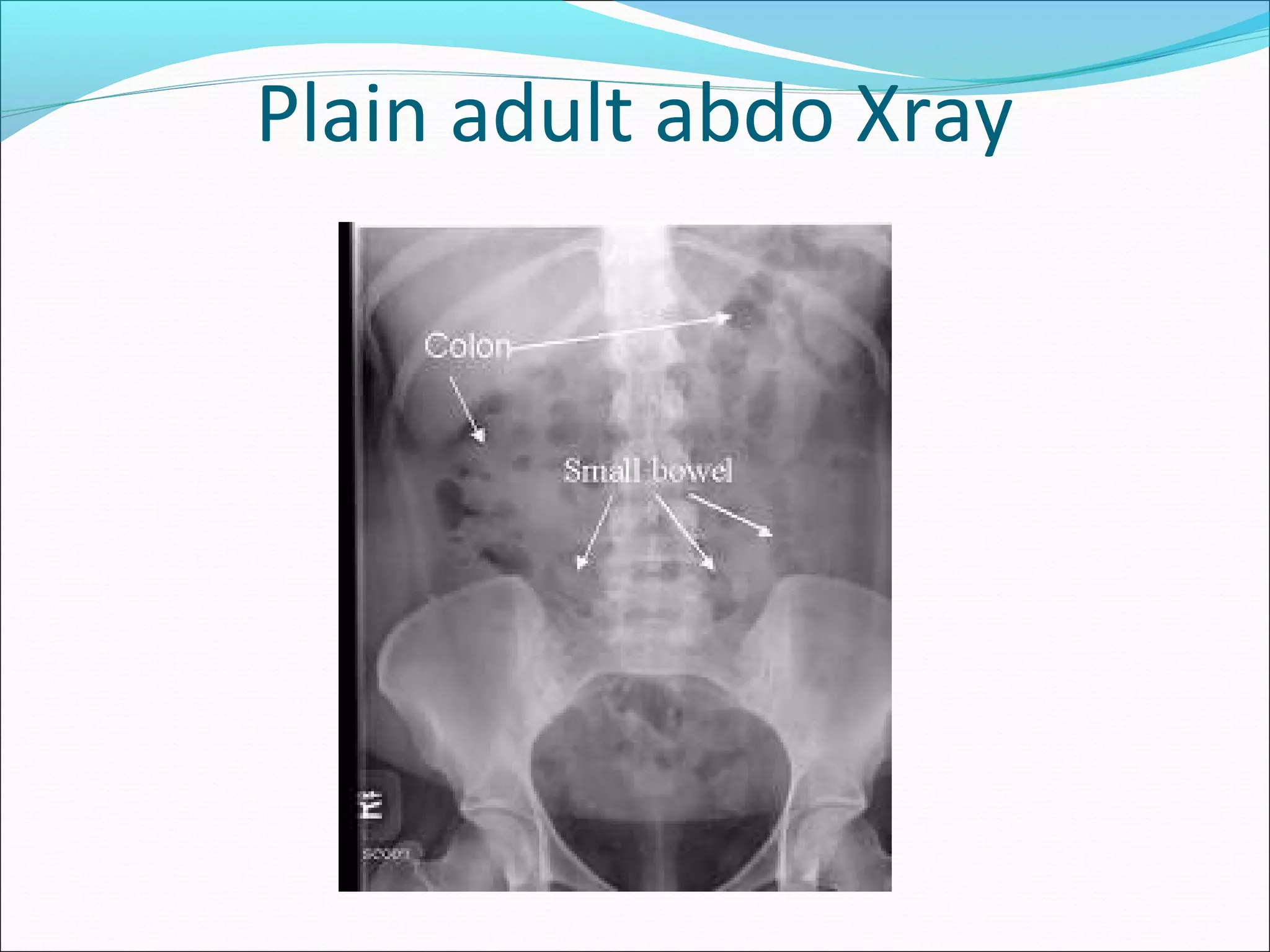 Abdominal xray images | PPT