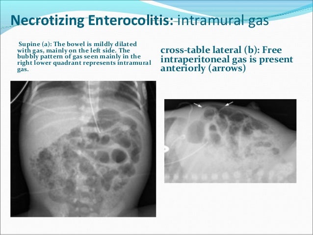 Abdominal xray images