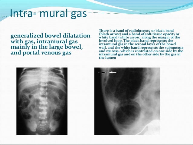 Abdominal xray images