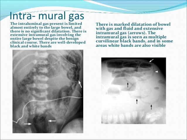 Abdominal xray images