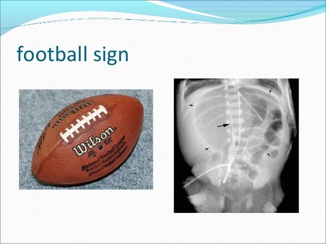 Abdominal xray images