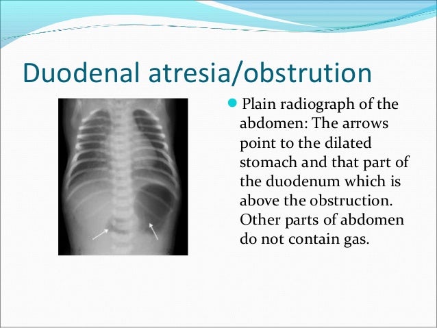 Abdominal xray images