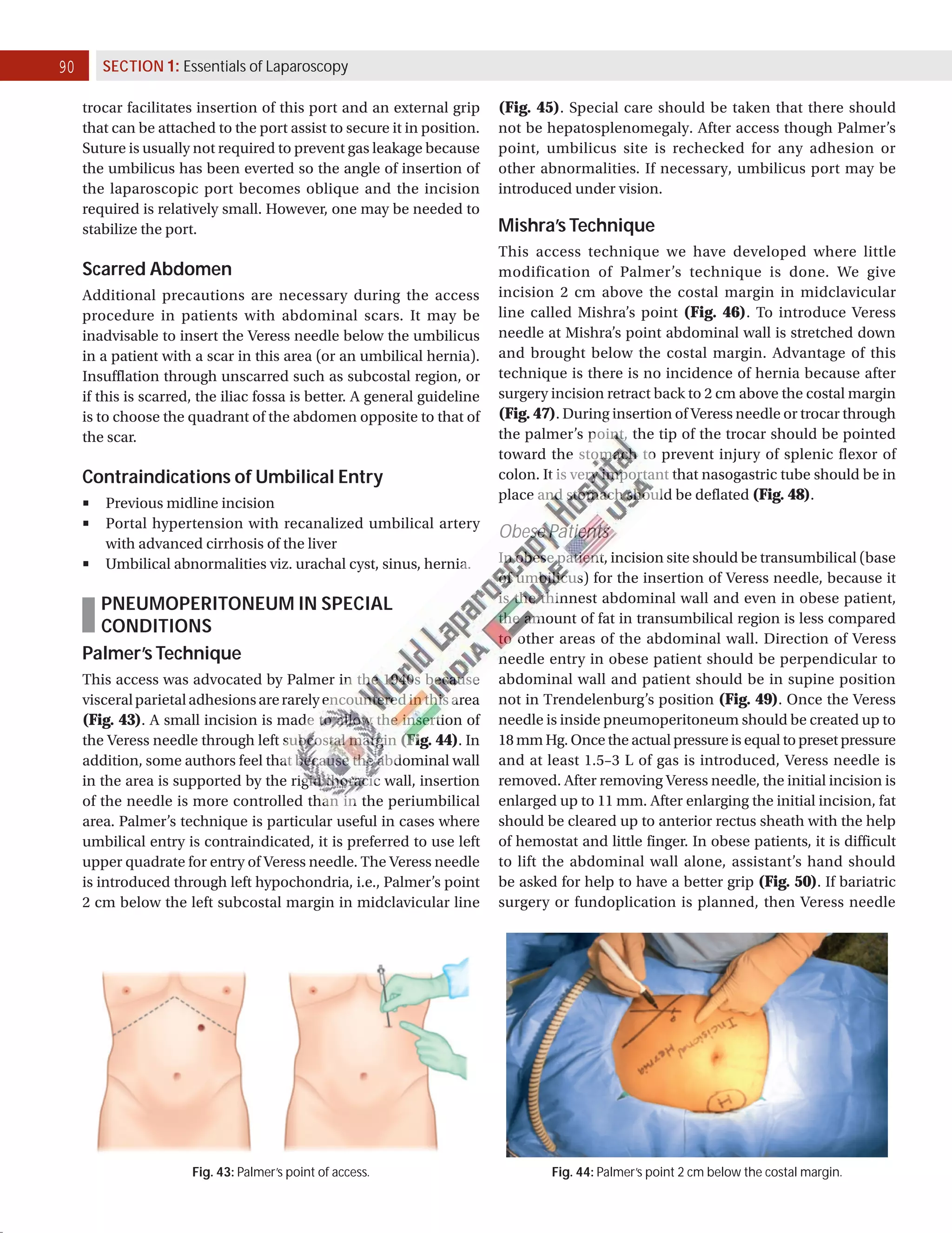 Abdominal access-techniques | PDF