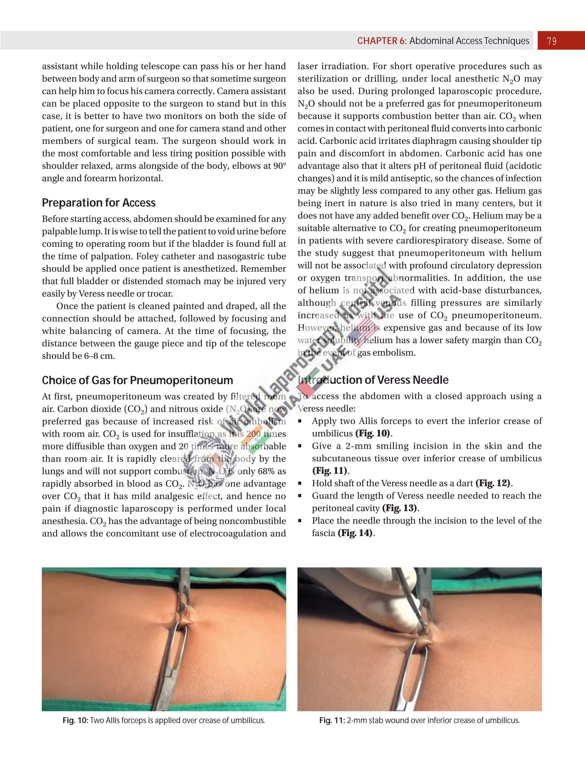 Abdominal access-techniques | PDF