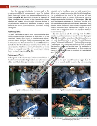 Abdominal access-techniques | PDF