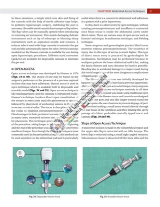 Abdominal access-techniques | PDF