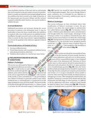 Abdominal access-techniques | PDF