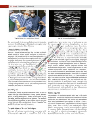 Abdominal access-techniques | PDF