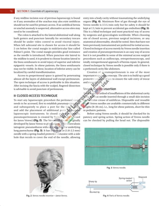 Abdominal access-techniques | PDF