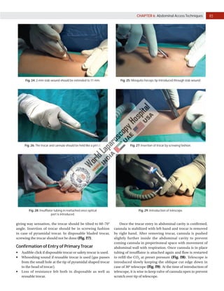 Abdominal-Access-Techniques.pdf