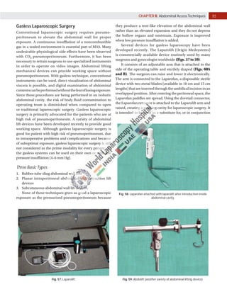 Abdominal-Access-Techniques.pdf