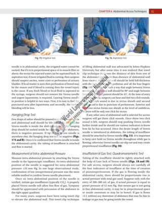 Abdominal Access Techniques with Prof. Dr. R K Mishra | PDF