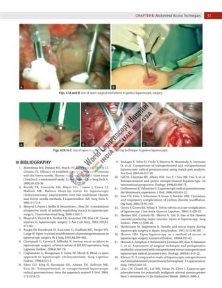 Abdominal Access Techniques in Laparoscopy.pdf