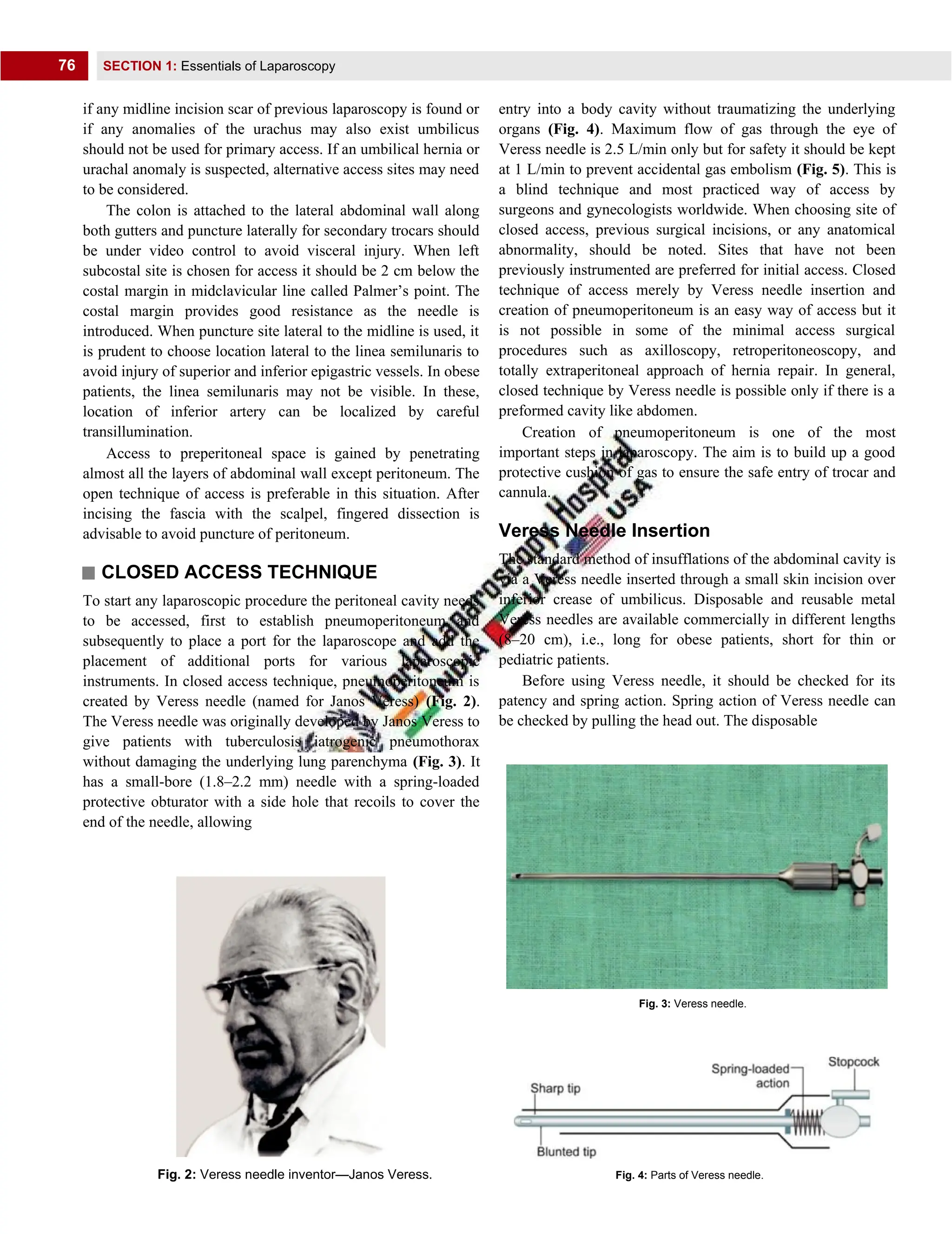 Abdominal Access Techniques at world laparoscopy hospital | DOC