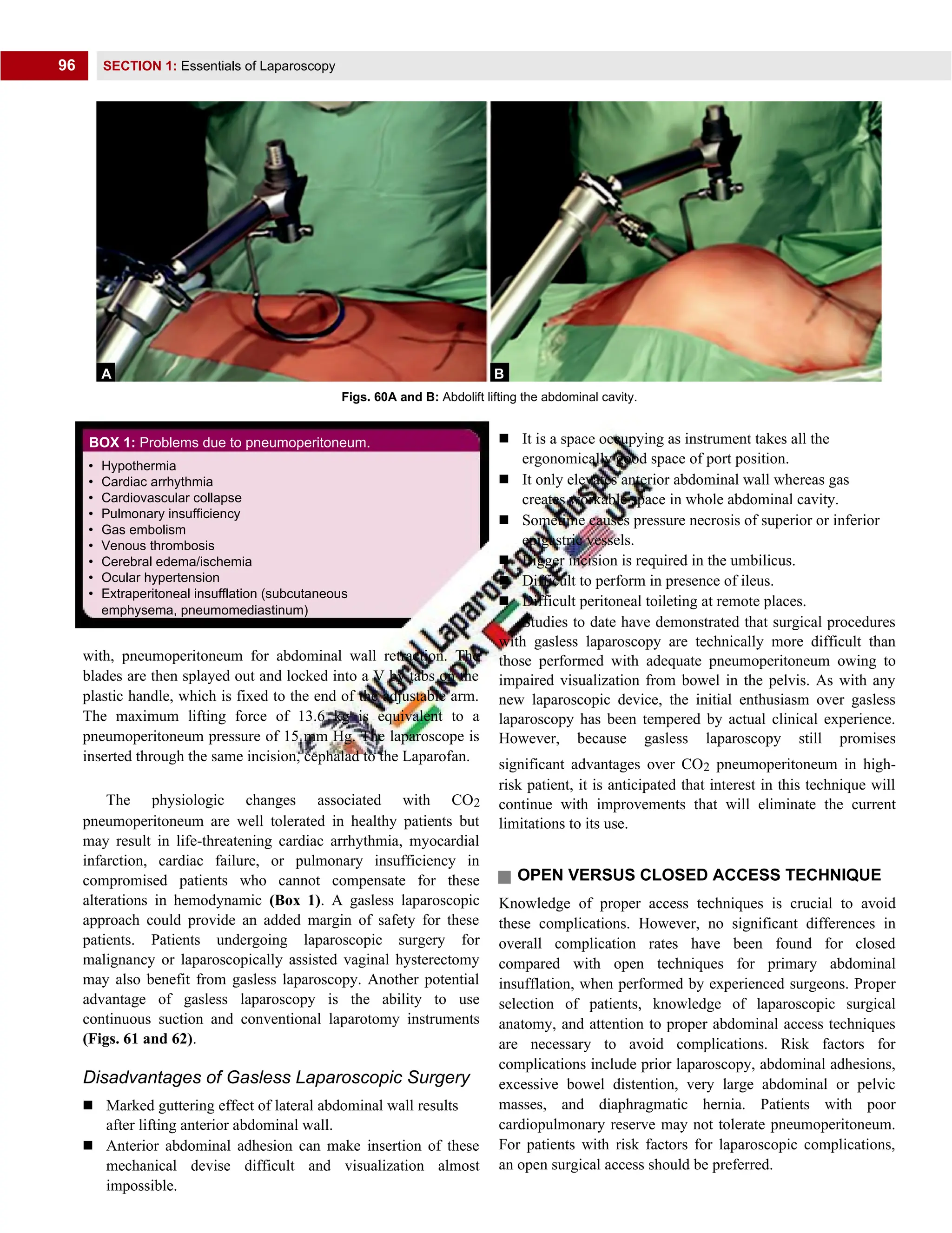 Abdominal Access Techniques at world laparoscopy hospital | DOC