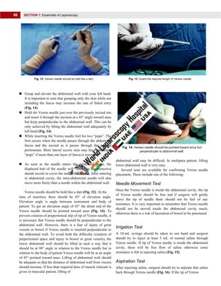 Abdominal Access Techniques at world laparoscopy hospital | DOC