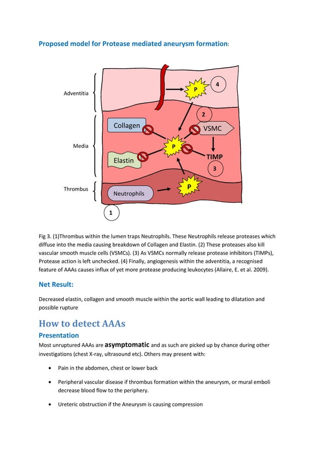 Abdominal Aortic Aneurysms | PDF