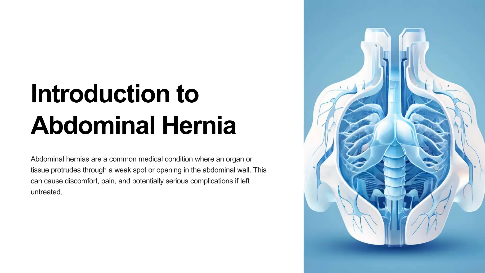 Abdominal Hernia 2pptxabdominal Hernia Ppt