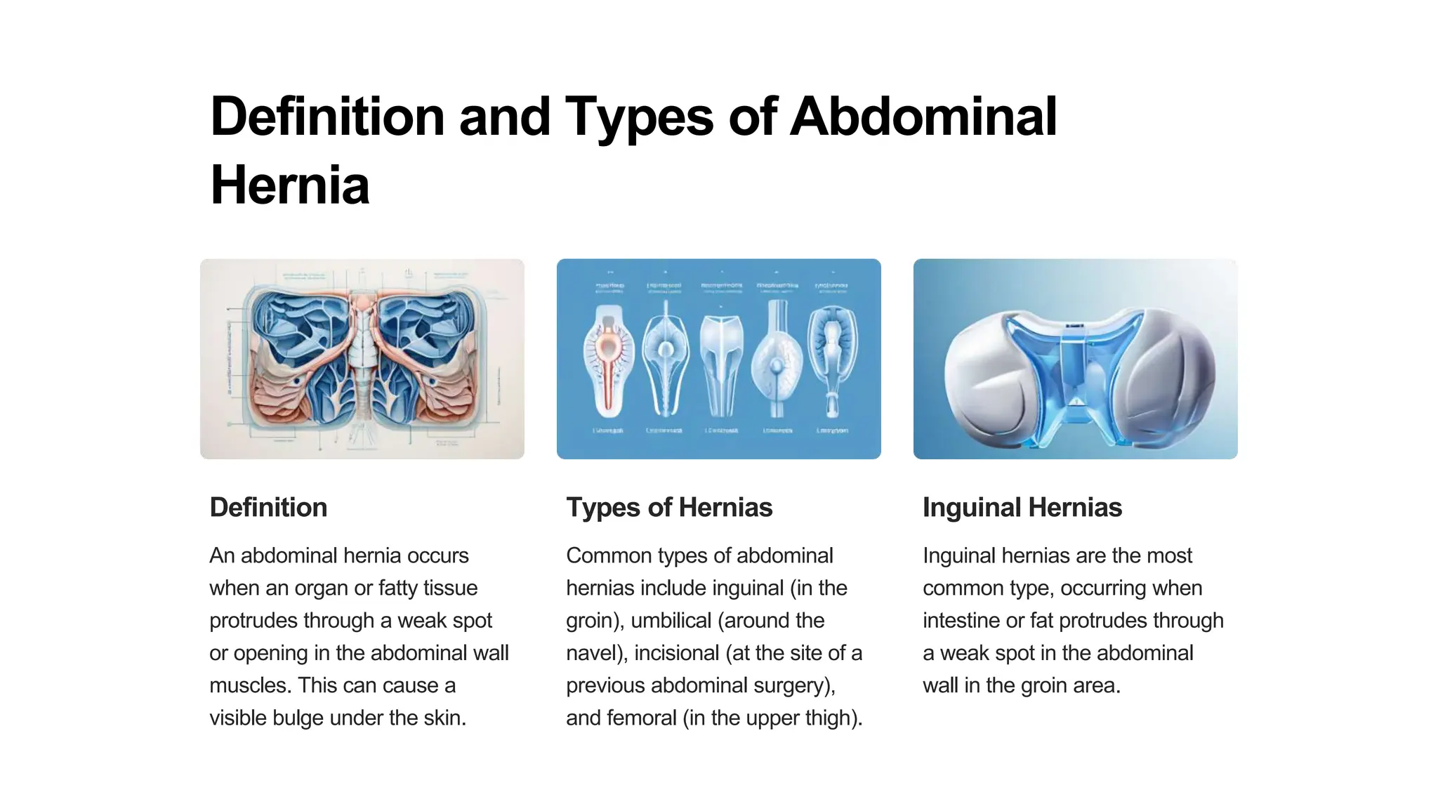 ABDOMINAL-HERNIA-2.pptx|ABDOMINAL HERNIA | PPTX