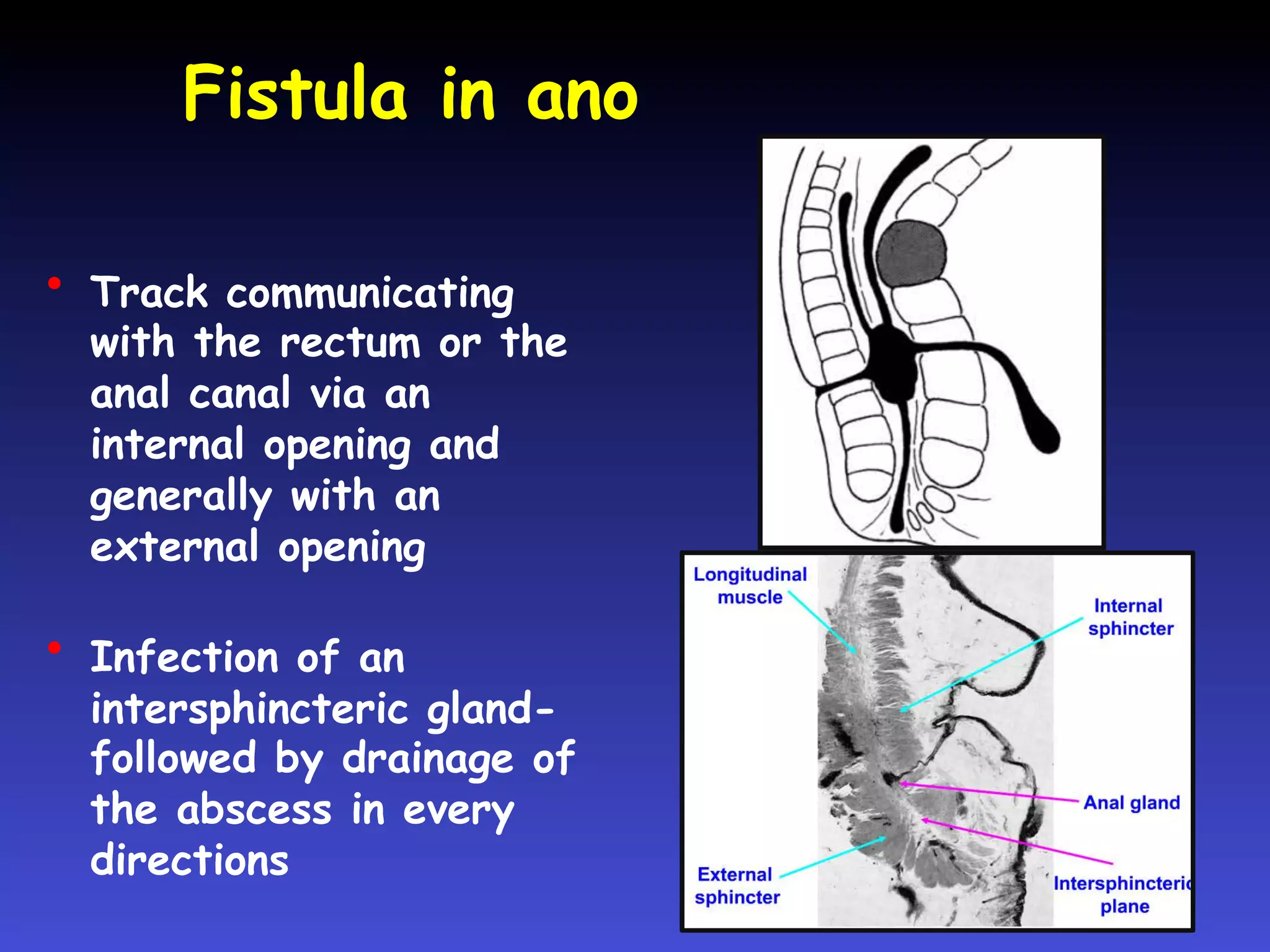 Abdominal imaging ano fistula jm tubiana | PDF