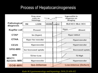 Abdominal imaging hcc t loke | PDF