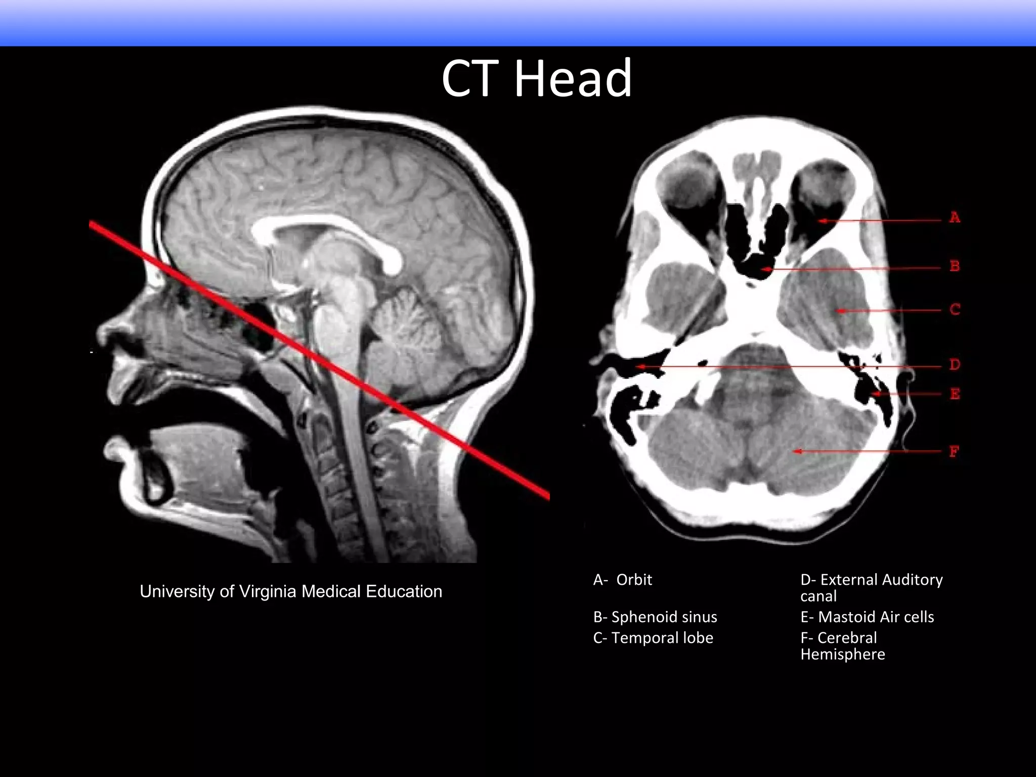 Abdominal Imaging Lecture | PPT Abdominal Imaging Lecture | PPT