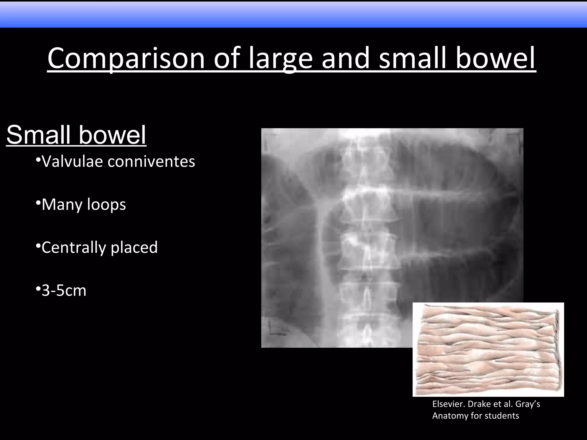 Abdominal Imaging Lecture | PPT