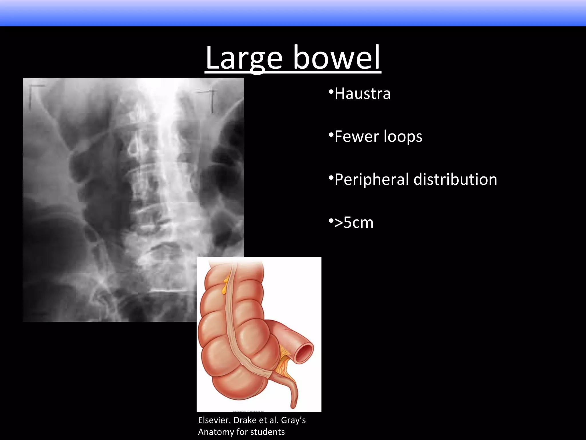Abdominal Imaging Lecture | PPT
