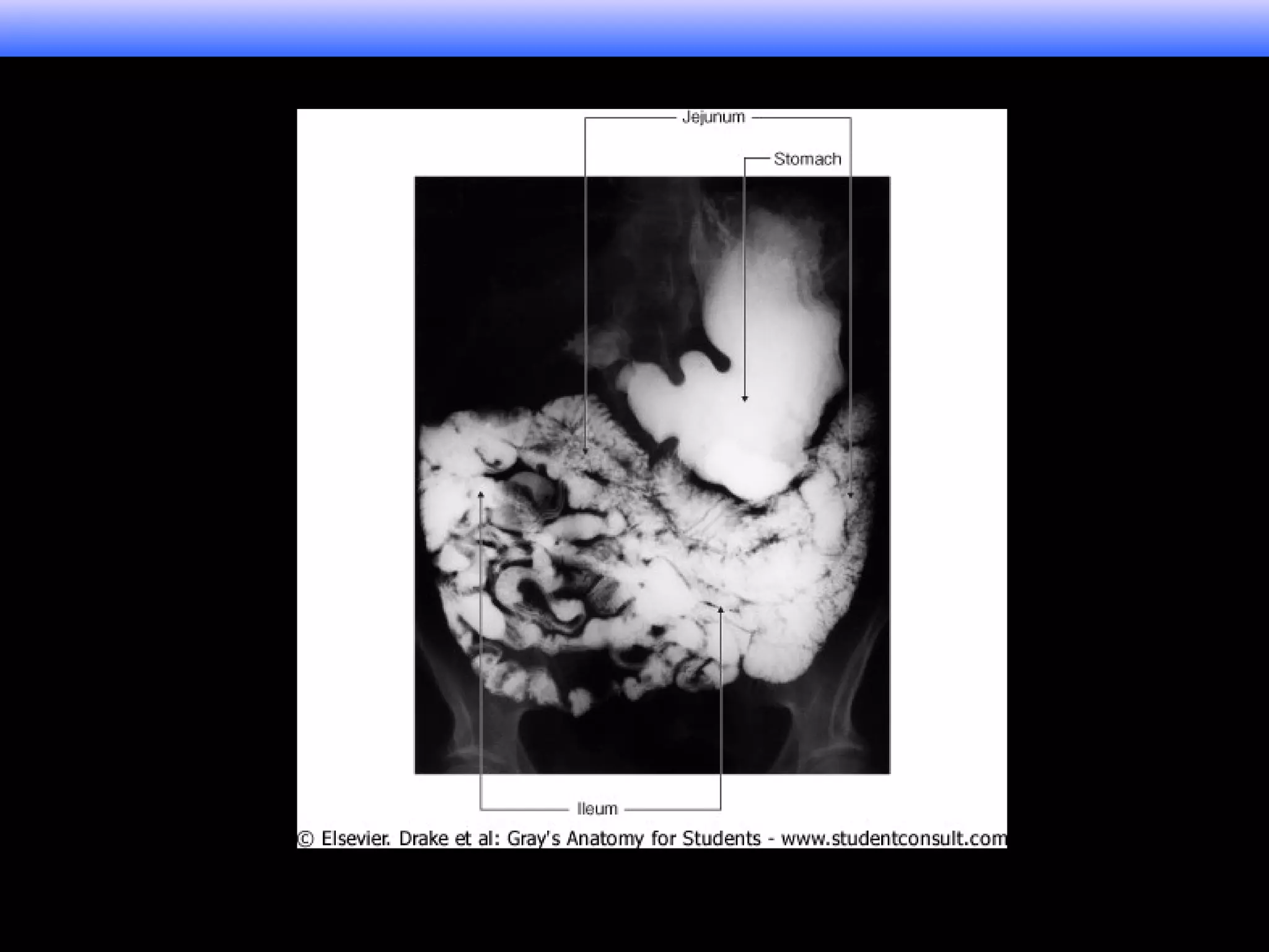 Abdominal Imaging Lecture | PPT