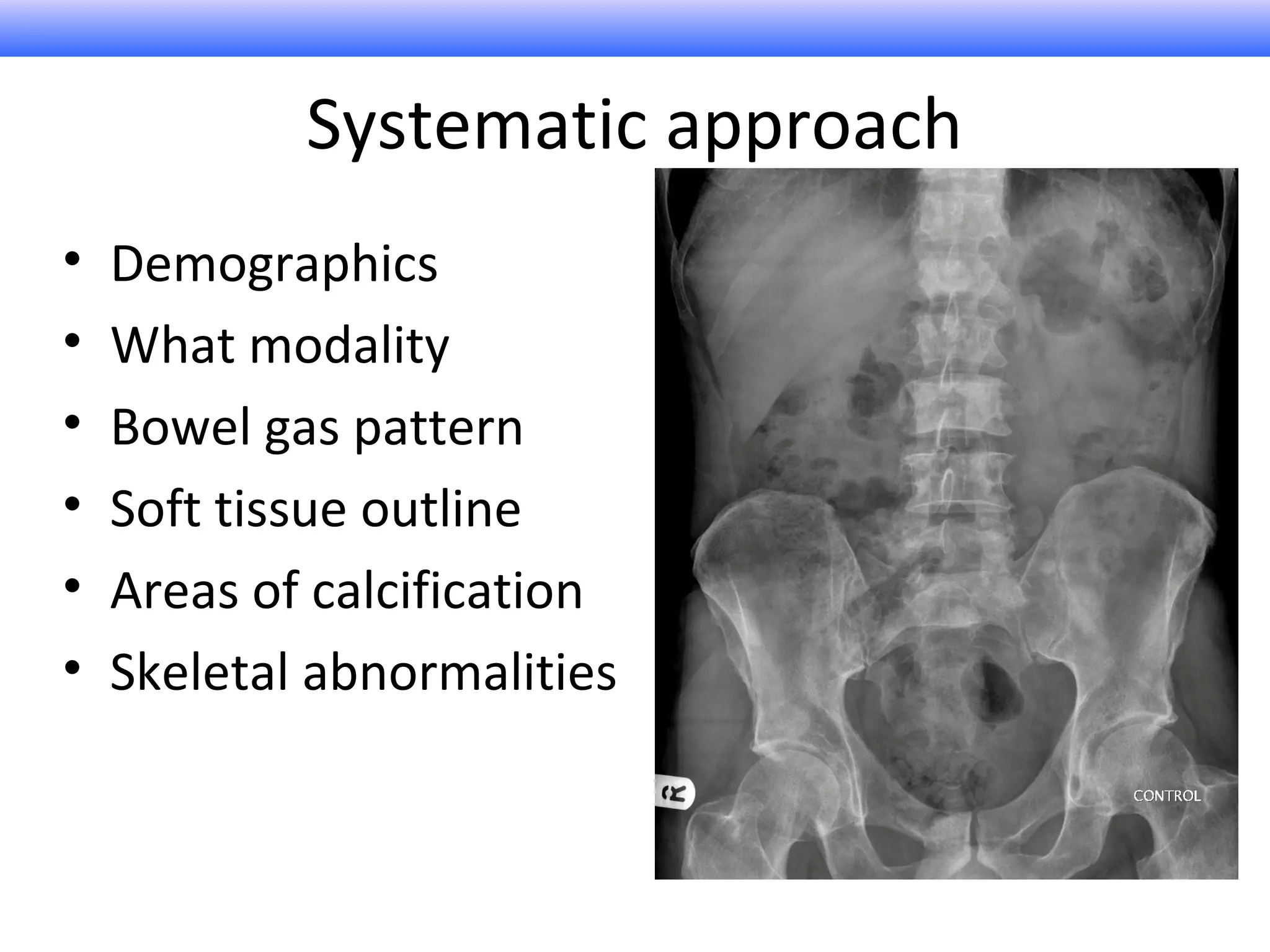 Abdominal Imaging Lecture | PPT