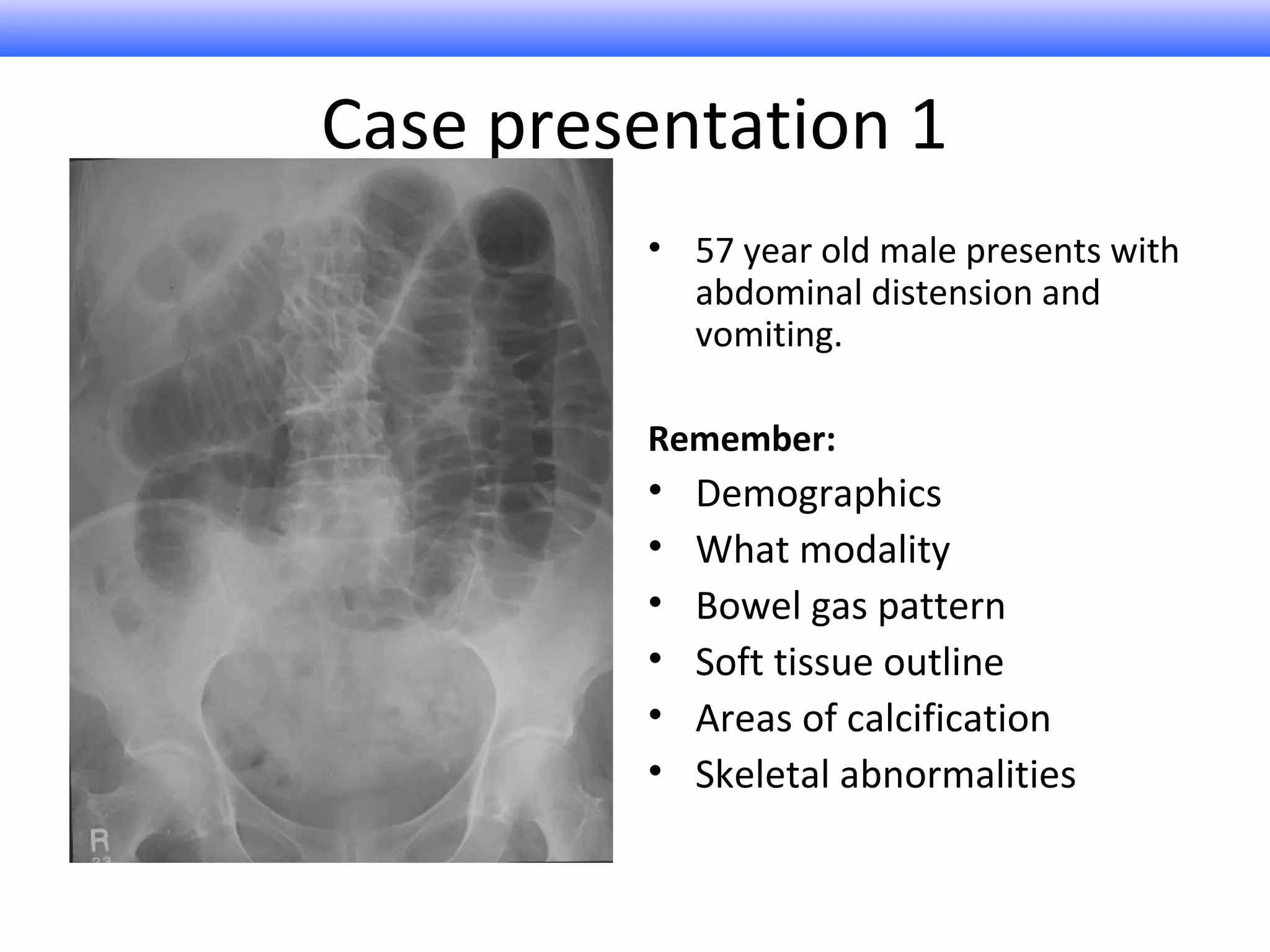 Abdominal Imaging Lecture | PPT