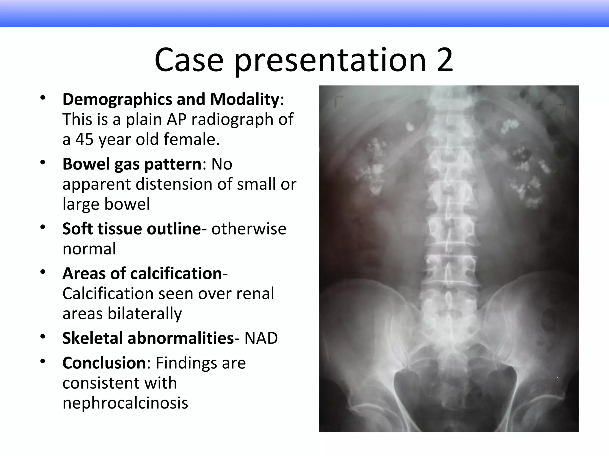 Abdominal Imaging Lecture | PPT