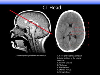 Abdominal Imaging Lecture | PPT