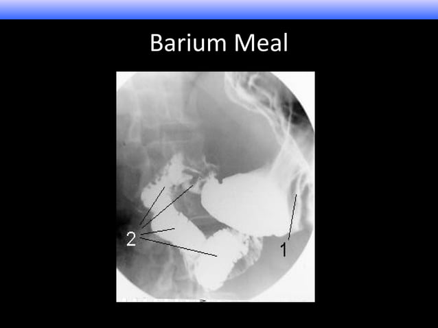 Abdominal Imaging Lecture | PPT