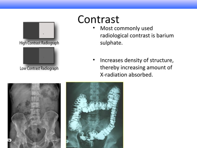Abdominal Imaging Lecture | PPT