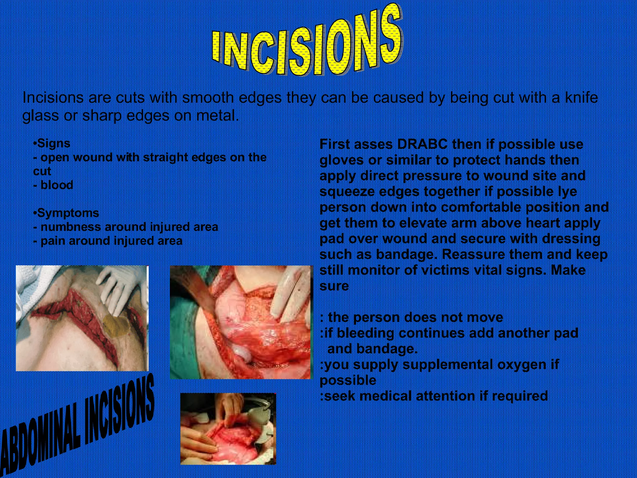 Abdominal Injuries | PPT