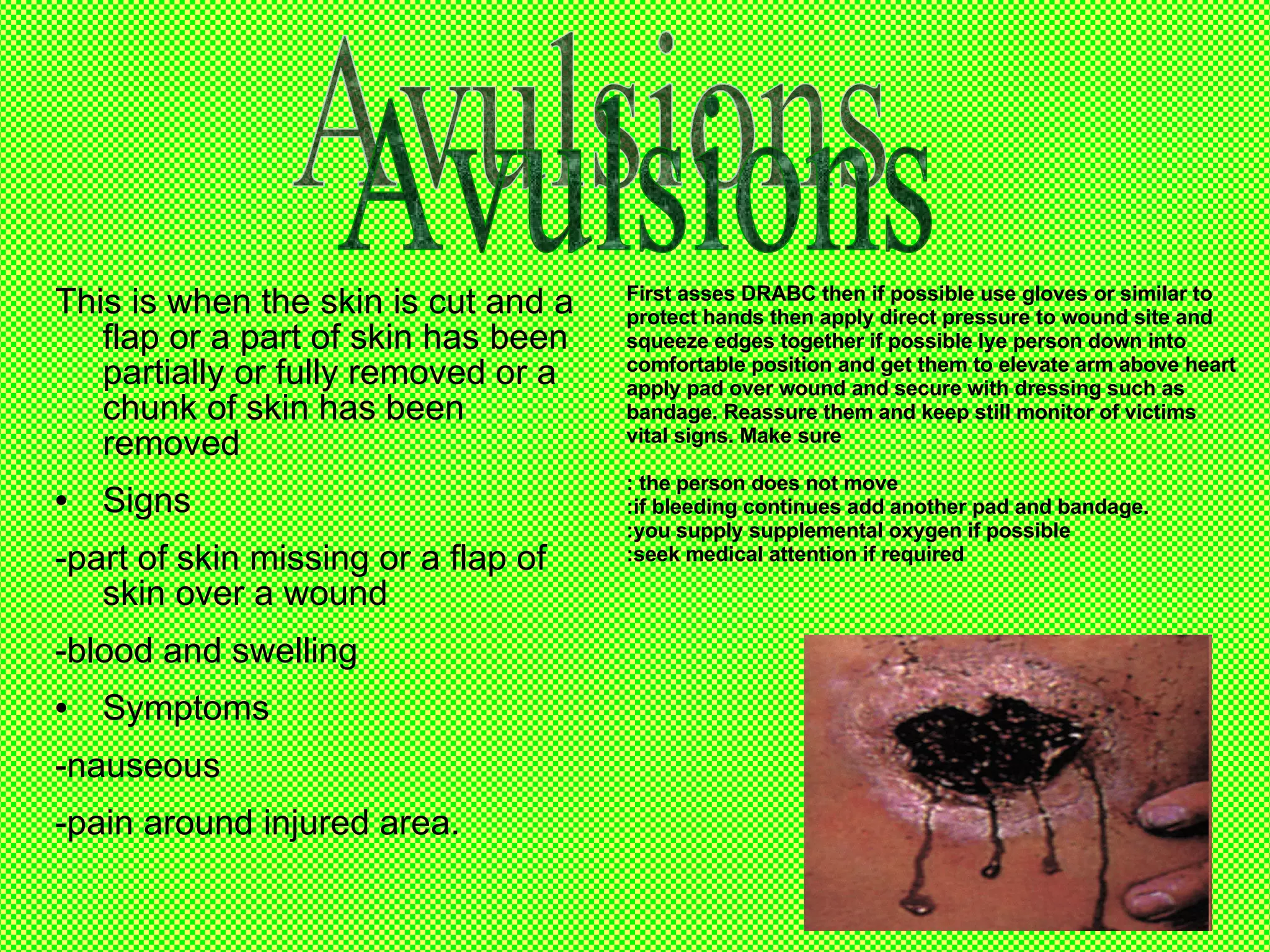 Abdominal Injuries | PPT