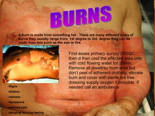 Abdominal Injuries | PPT