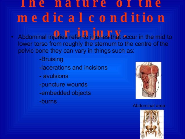 Abdominal Injuries | PPT