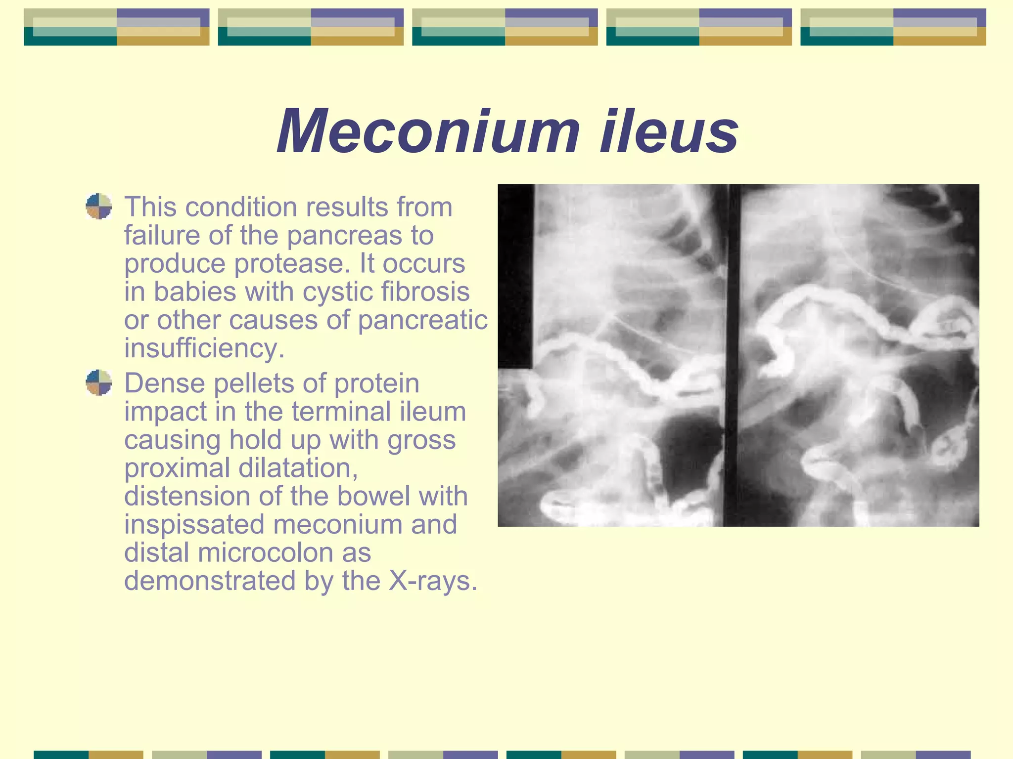Abdominal Problems In Children | PPT