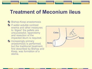Abdominal Problems In Children | PPT